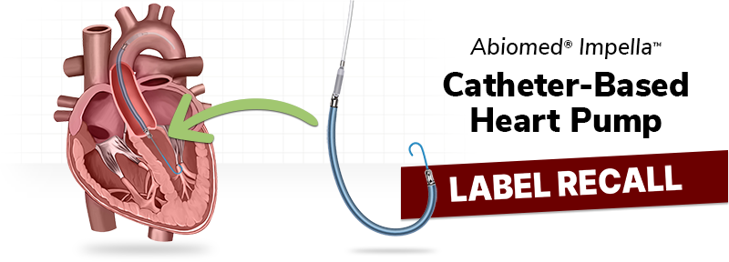 Abiomed® Impella™ Cardiac Pump Lawsuit (05 2024)